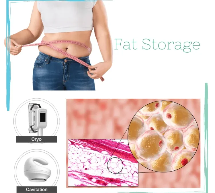 Fat Cells and Fat Storage: Explanation & Fat Burning Tips