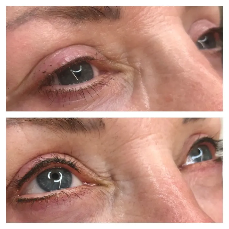 Eyeliner Tattoo In St Helens