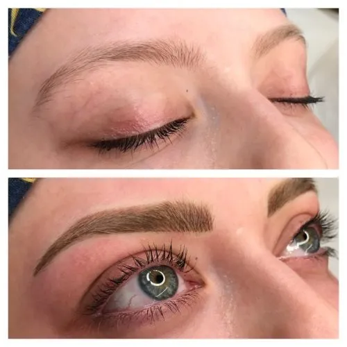 Overplucked and Sparse Eyebrows